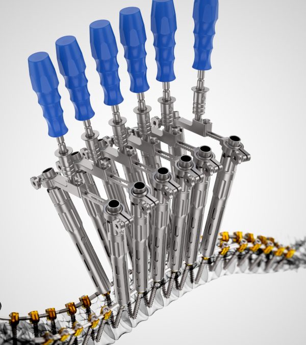 SISTEMA PARA ESCOLIOSE NEOSPINE – Jusimed Equipamentos Médicos de ...